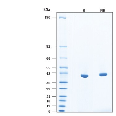 Recombinant Human GOT1 His-tag Protein, CF 11696-G1-050: R&D Systems