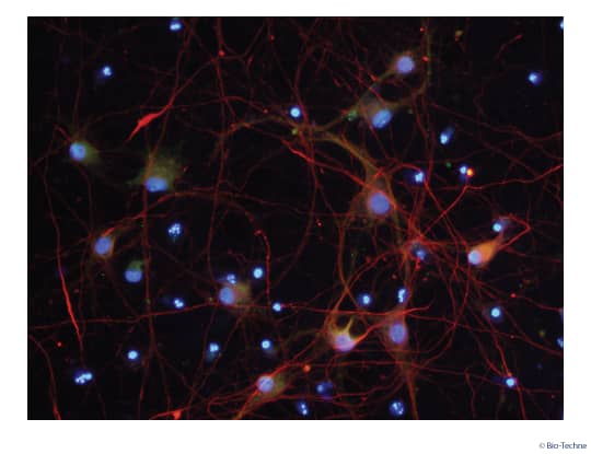 NeuroXVivo Rat Motor Neuron Culture Kit (CDK016) | Bio-Techne