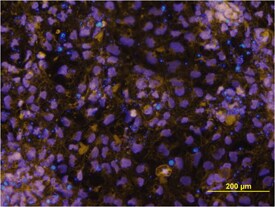 Human Brachyury Antibody MAB2085: R&D Systems