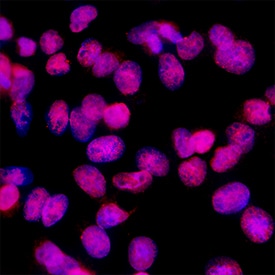 Human METTL3 Antibody MAB11514-100: R&D Systems
