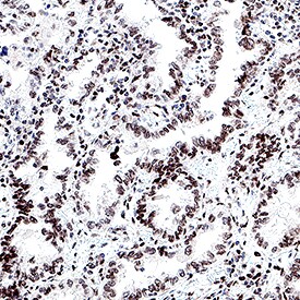 Human METTL3 Antibody MAB11514-100: R&D Systems