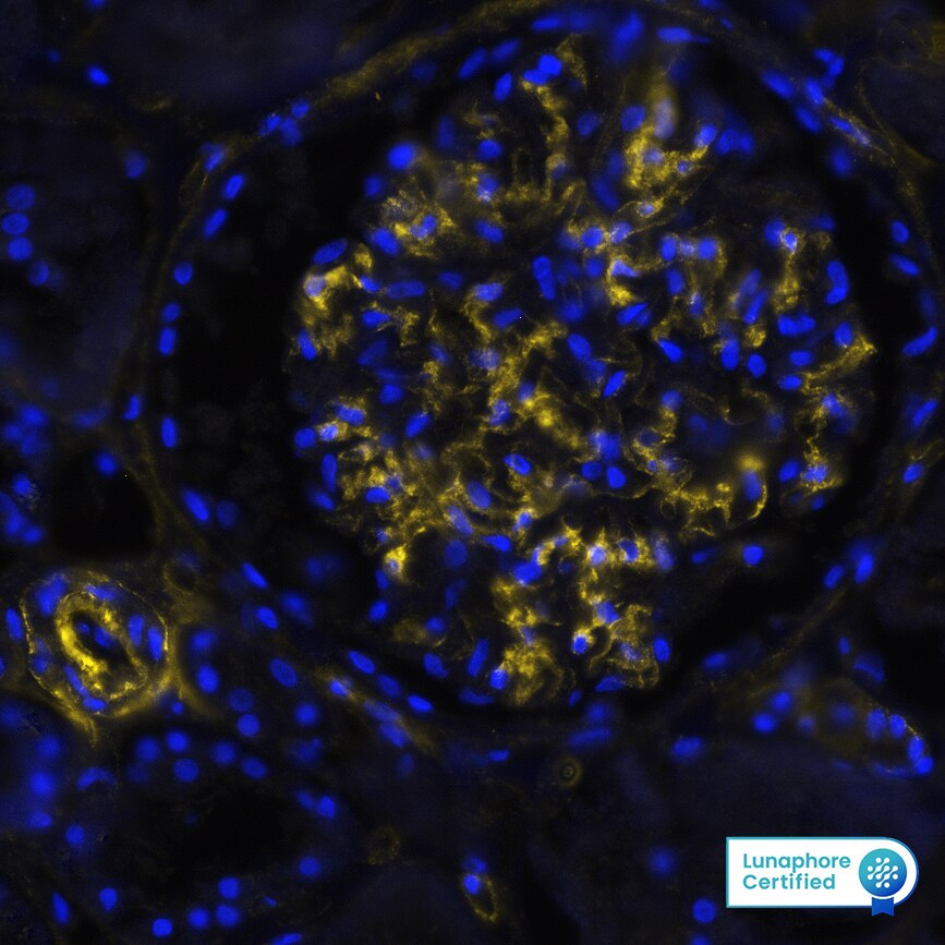 Human Collagen IV alpha 1 Antibody MAB11758-100: R&D Systems