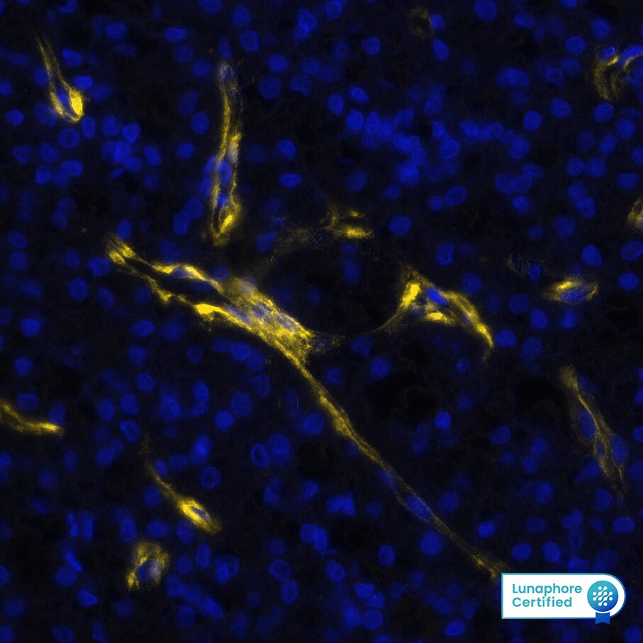 Human Collagen IV alpha 1 Antibody MAB11758-100: R&D Systems