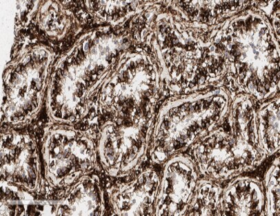 Mouse VisUCyte HRP Polymer-DAB Cell & Tissue Staining Kit VCTS001B: R&D ...