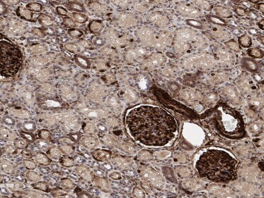 Mouse/Rabbit VisUCyte HRP Polymer-DAB Staining Kit VCTS002B: R&D Systems