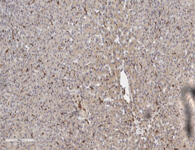 Goat VisUCyte HRP Polymer-DAB Cell & Tissue Staining Kit VCTS004B: R&D ...