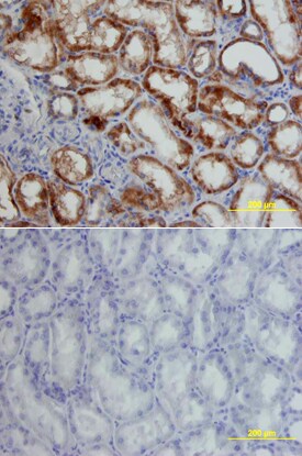 IHC-Images: HIF-1 alpha/HIF1A: R&D Systems