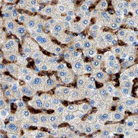 IHC-Images: MMR/CD206: R&D Systems