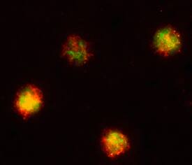 IHC-Images: Myeloperoxidase/MPO: R&D Systems