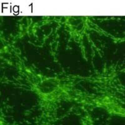 ATPB Antibody (4.3E8.D10) NB600-1171: Novus Biologicals