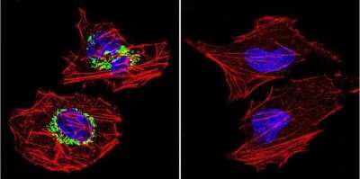 ATPB Antibody (4.3E8.D10) NB600-1171: Novus Biologicals