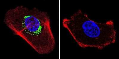 ATPB Antibody (4.3E8.D10) NB600-1171: Novus Biologicals