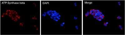 ATPB Antibody (4.3E8.D10) NB600-1171: Novus Biologicals