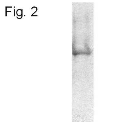 ATPB Antibody (4.3E8.D10) NB600-1171: Novus Biologicals