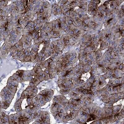 DPPIV/CD26 Antibody - BSA Free NBP3-16980: Novus Biologicals