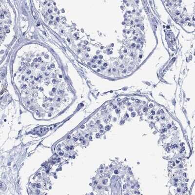 DPPIV/CD26 Antibody - BSA Free NBP3-16980: Novus Biologicals