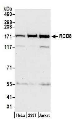 EDC4 Antibody NB100-2273: Novus Biologicals