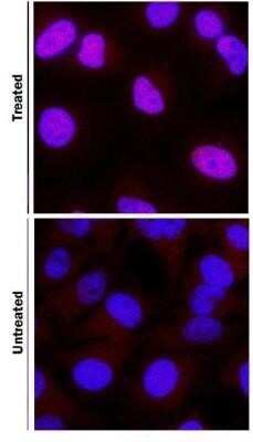 HIF-1 alpha Antibody (H1alpha67) - Azide and BSA Free NBP2-80760: Novus ...