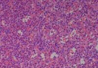 Human Multi-Organ Tissue MicroArray (Normal) NBP2-30189: Novus Biologicals