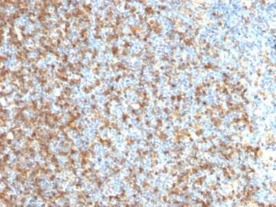 LMO2 Antibody (LMO2/1971) - Azide and BSA Free NBP3-08268: Novus ...