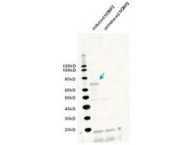 L1/ORF2 Antibody - BSA Free NBP1-77929: Novus Biologicals