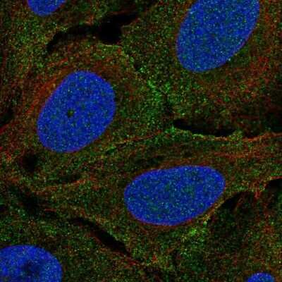 Plexin A4 Antibody - BSA Free NBP2-69011: Novus Biologicals