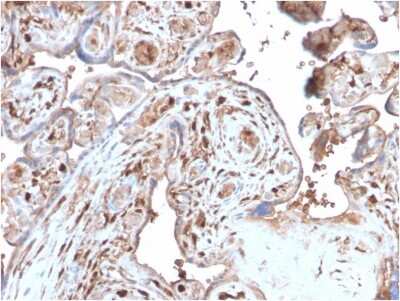 S100A4 Antibody (S100A4/2750R) - Azide and BSA Free NBP3-08460: Novus ...