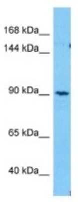 SEZ6L2/BSRP-A Antibody - BSA Free NBP3-10995: Novus Biologicals