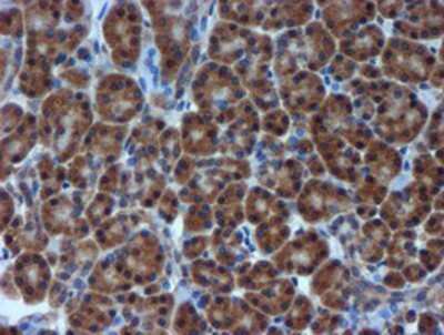 TIMP-2 Antibody (OTI1A6) - Azide and BSA Free NBP2-74521: Novus Biologicals