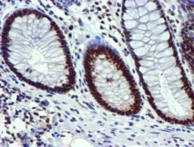 USP7 Antibody (OTI1F12) - Azide and BSA Free NBP2-74814: Novus Biologicals