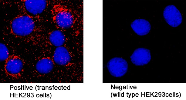 Membrane Antibodies