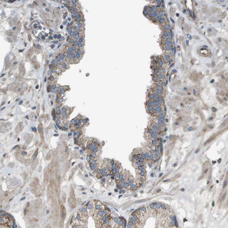 NRK Antibody - BSA Free NBP1-84121: Novus Biologicals