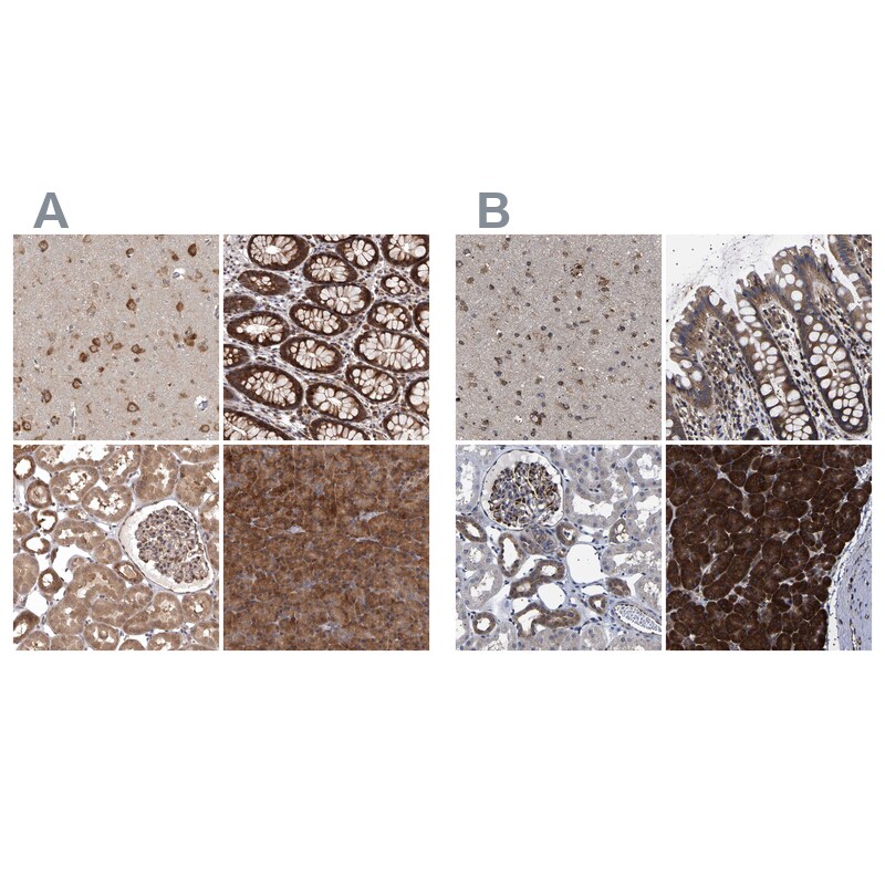 DARS Antibody - BSA Free NBP1-85937: Novus Biologicals