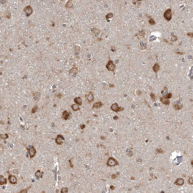 DARS Antibody - BSA Free NBP1-85937: Novus Biologicals