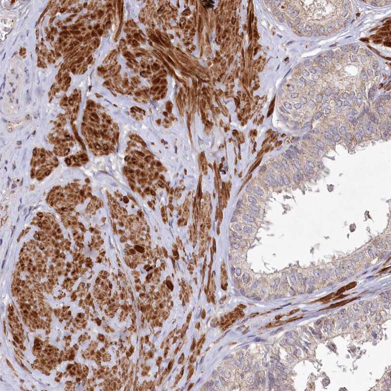 PSTK Antibody - BSA Free NBP1-88541: Novus Biologicals
