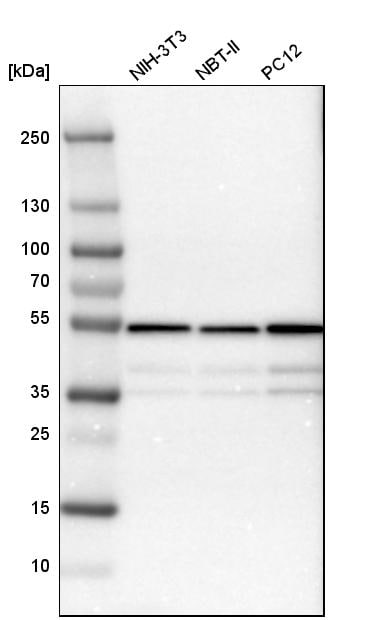 ATPB Antibody - BSA Free NBP1-90816: Novus Biologicals