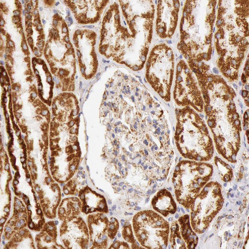 ATPB Antibody - BSA Free NBP1-90816: Novus Biologicals