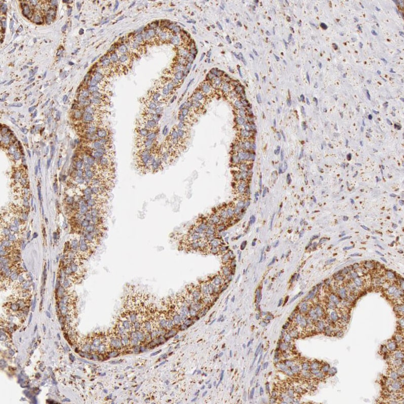 ATPB Antibody - BSA Free NBP1-90816: Novus Biologicals