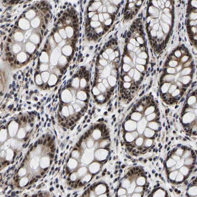 SKAR Antibody - BSA Free NBP1-92392: Novus Biologicals