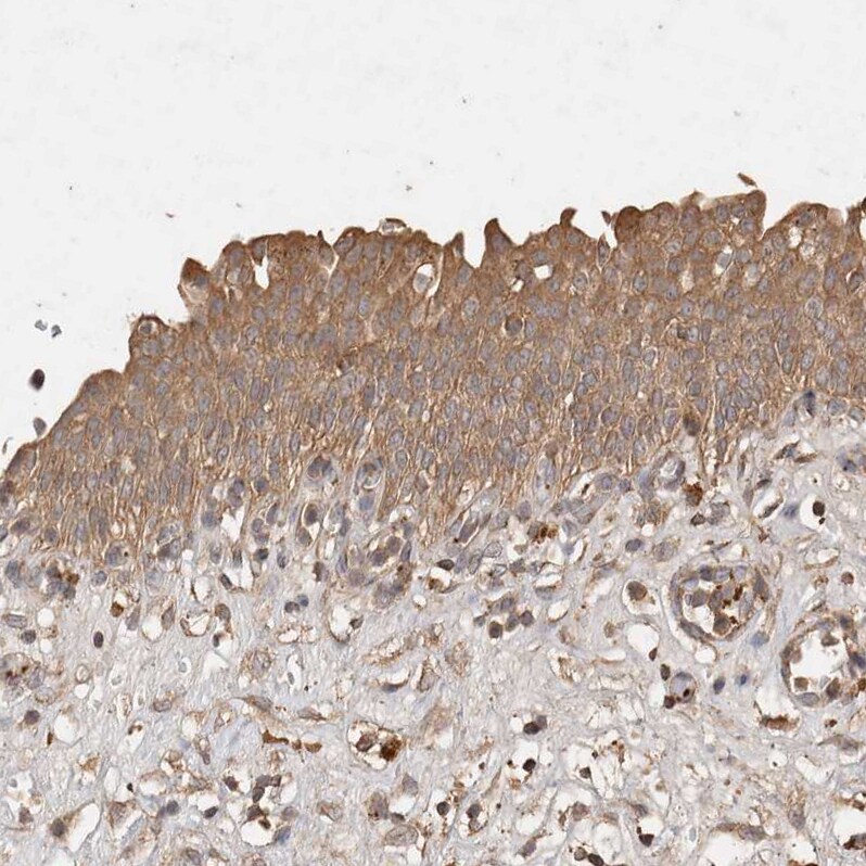 Sorting Nexin 31 Antibody - BSA Free NBP1-92423: Novus Biologicals