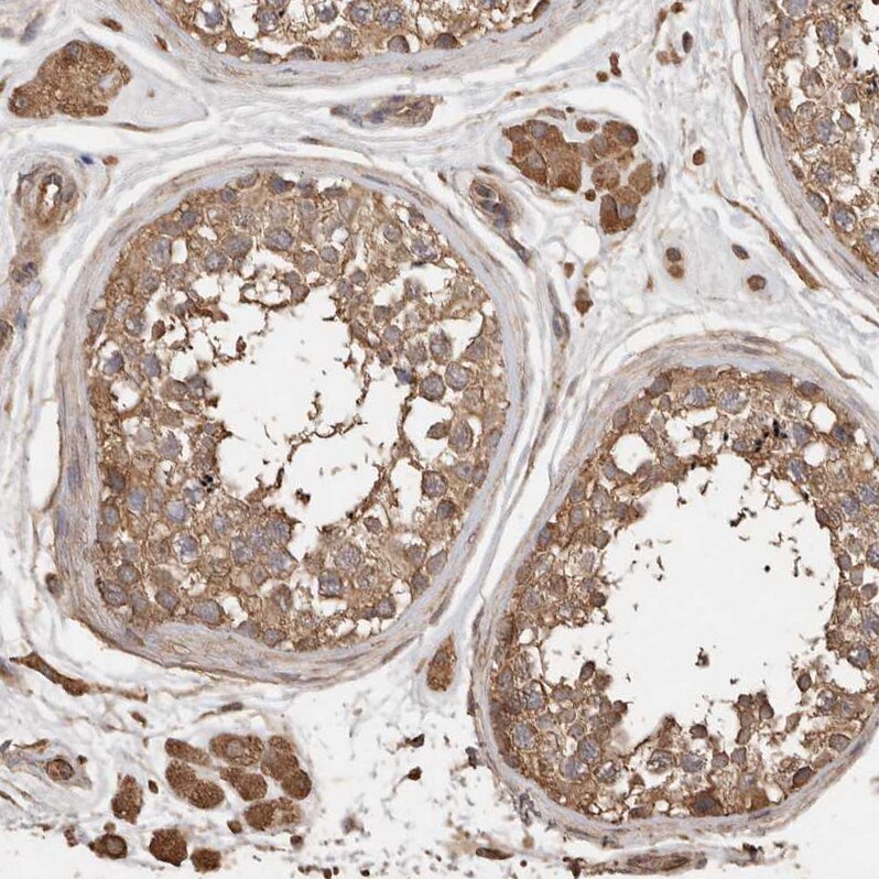 Sorting Nexin 31 Antibody - BSA Free NBP1-92423: Novus Biologicals