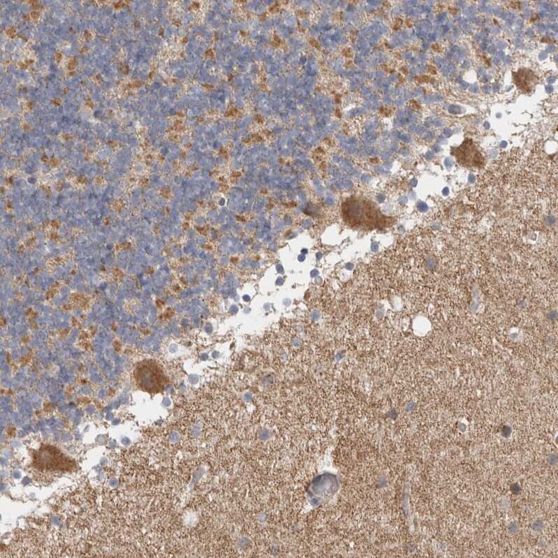 HROB Antibody - BSA Free NBP1-93494: Novus Biologicals