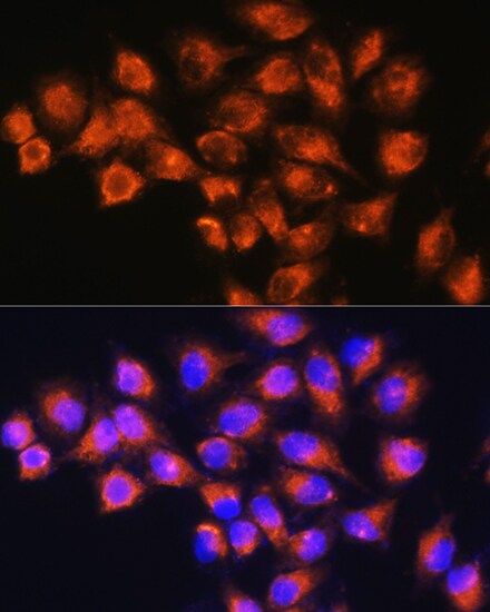 Neuropeptide B Antibody - Azide and BSA Free NBP3-05567: Novus Biologicals