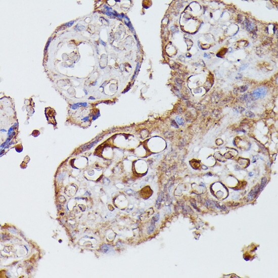 Serpin A8/Angiotensinogen Antibody - BSA Free NBP3-35581: Novus Biologicals