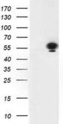 p53 Antibody (OTI5E2) NBP2-00723: Novus Biologicals