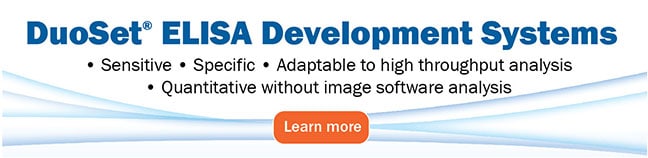 DuoSet ELISA: R&D Systems
