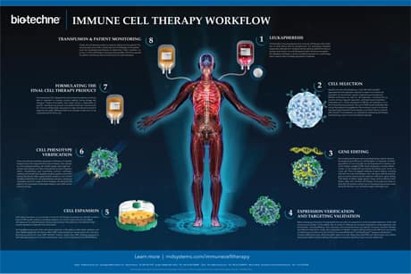Immune Cell Therapy Workflow Wall Poster
