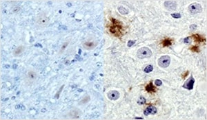 Dual ISH-IHC Antibody Validation: R&D Systems