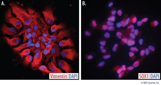Neural Progenitor Marker Antibody Panel (SC025): R&D Systems
